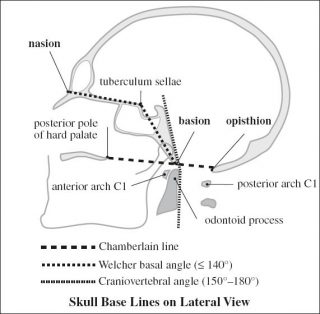 Ossa della testa: osso occipitale | MedicinaGram